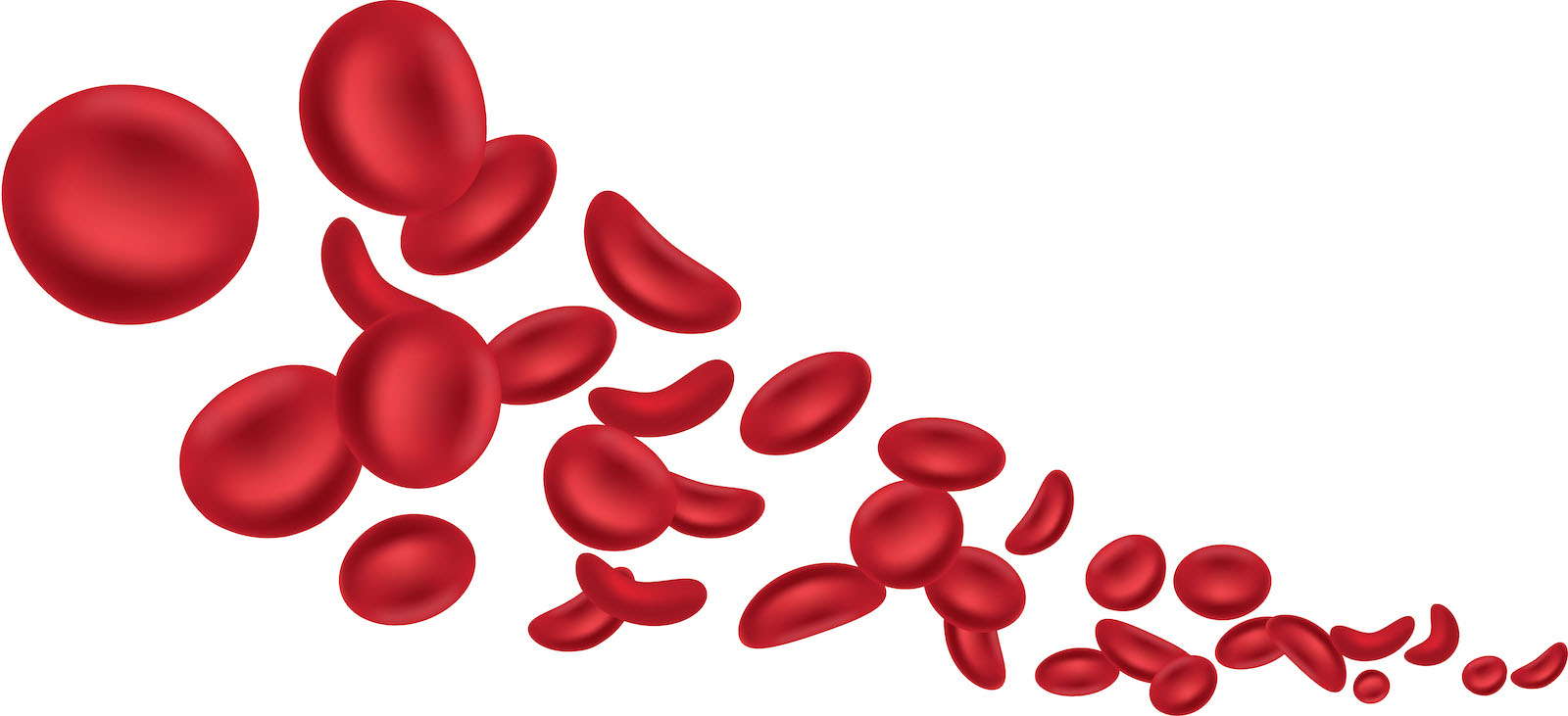 Untreated Anemia Can Be Life-Threatening