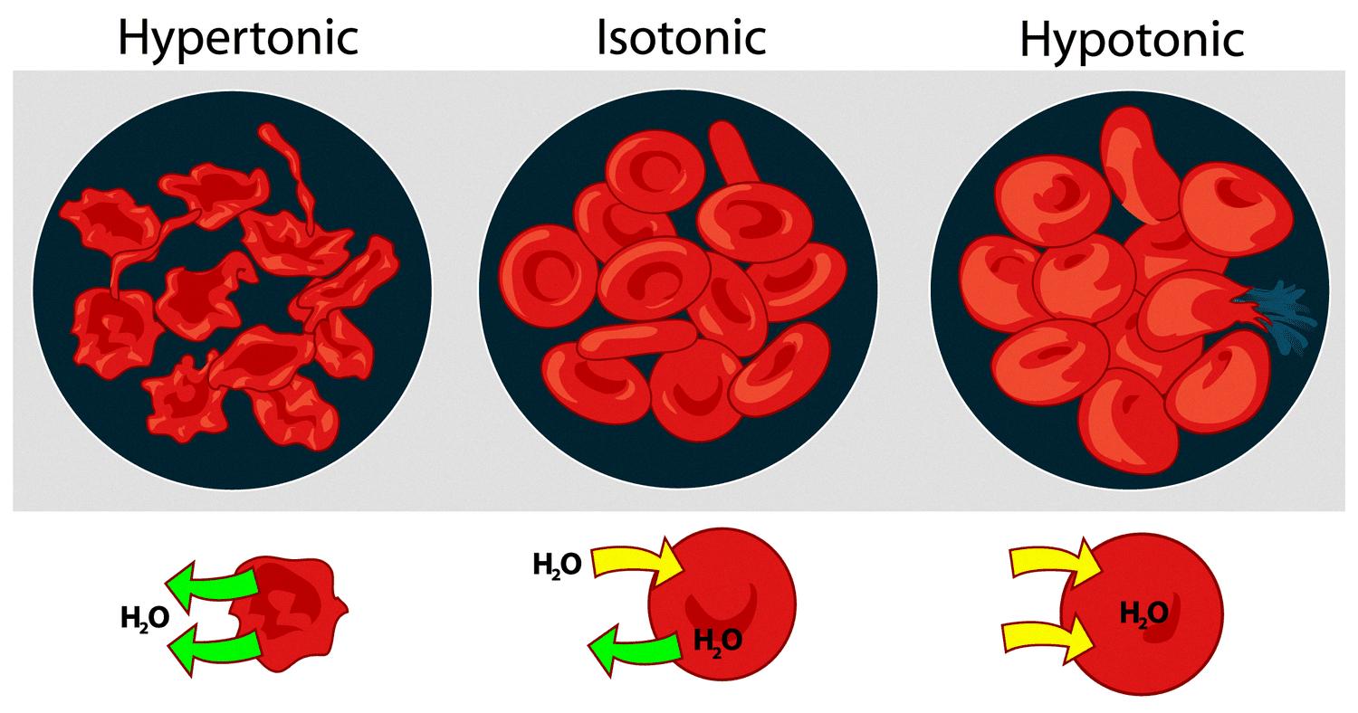 The Difference Between Hypertonic And Hyperosmotic Solutions Assessed